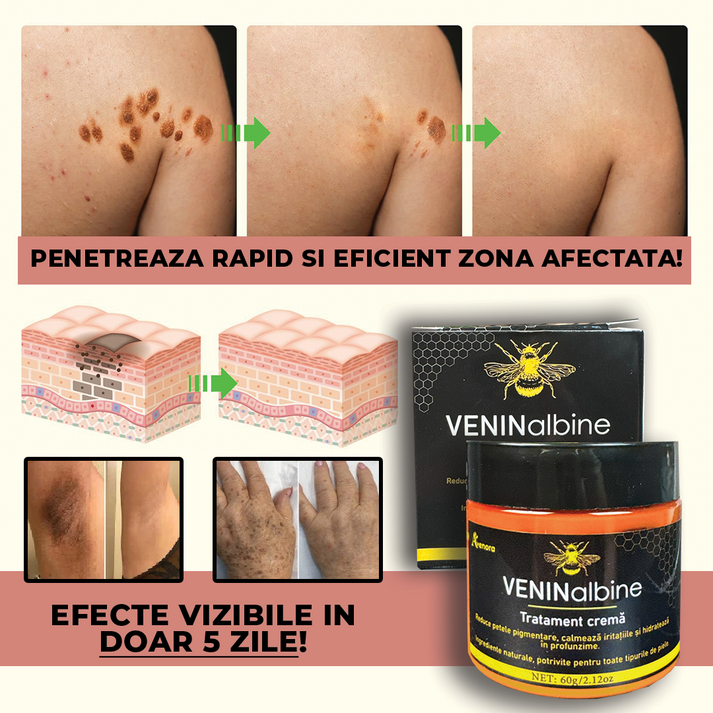 Crema pentru piele cu venin de albine – Avenora